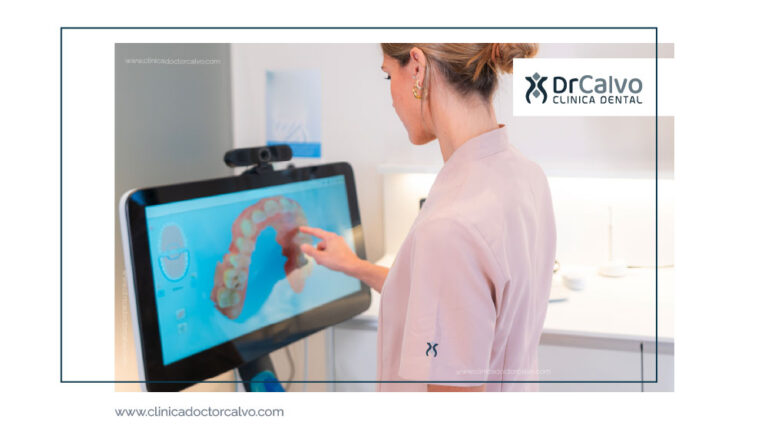 Escáner intraoral: la revolución digital en odontología