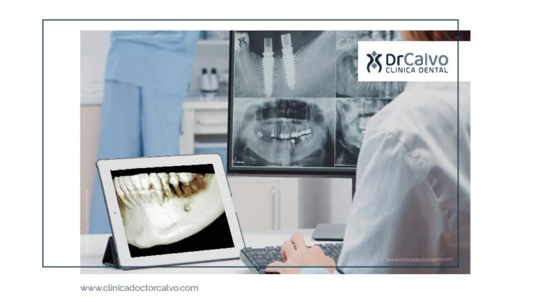 Radiografías 3D en Odontología - Clínica dental Doctor Calvo en Sevilla