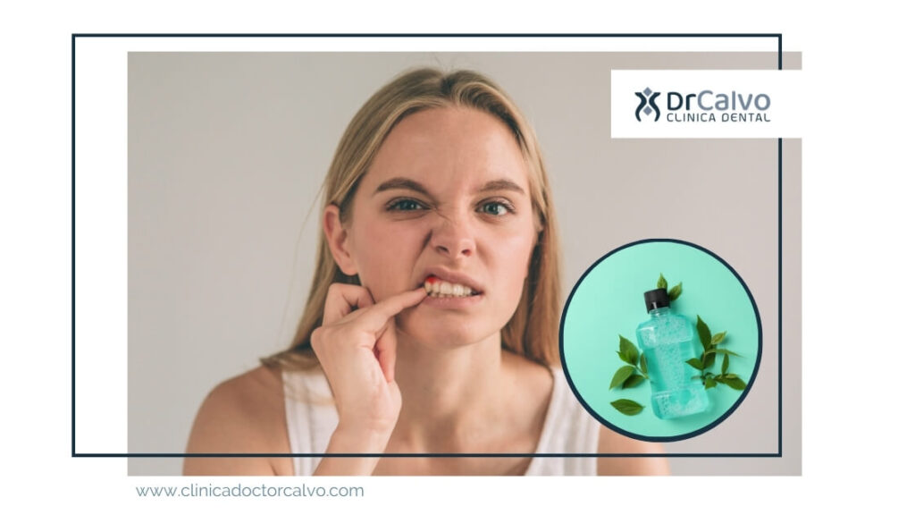 Enjuagues para el tratamiento de la inflamación de encías | Clínica ...