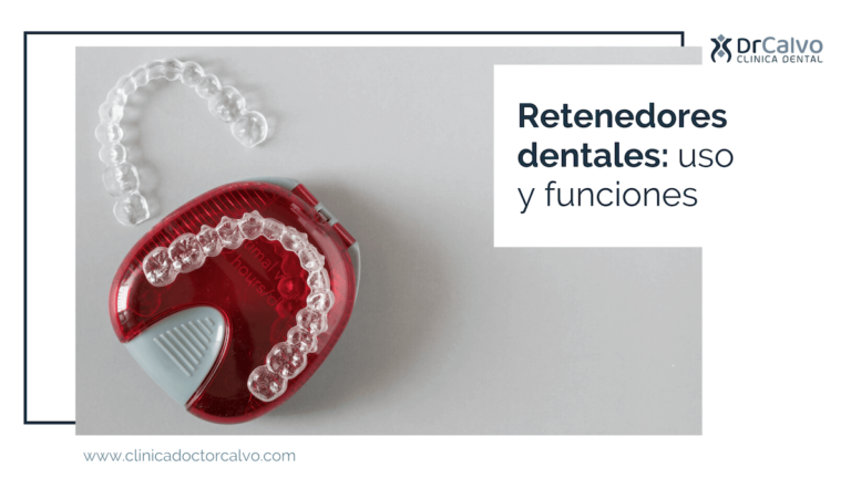 Retenedores dentales: uso y funciones | Clínica Doctor Calvo